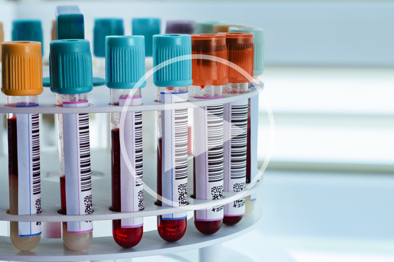 Quantification of proteins in complex biological samples by LC-MS/MS ...