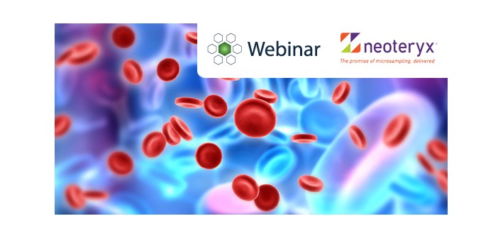 How to successfully implement microsampling (and other disruptive technologies) - Bioanalysis Zone