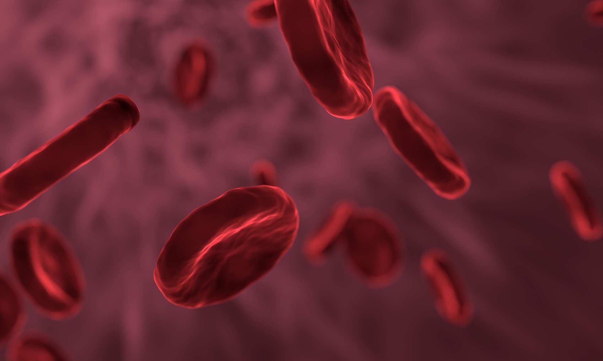 Free hemoglobin determination at patients' bedside to evaluate ... Free hemoglobin determination at patients' bedside to evaluate ...