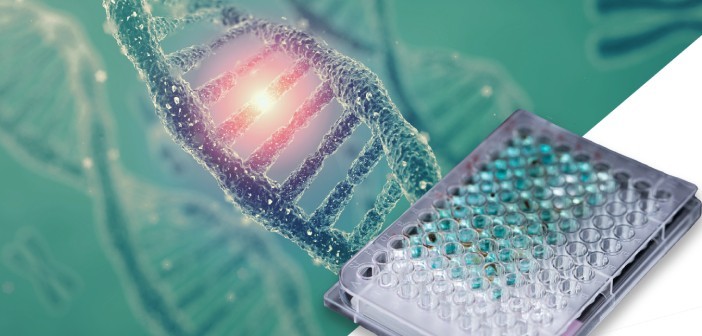 ELISpot method development and validation for gene therapies: building ...