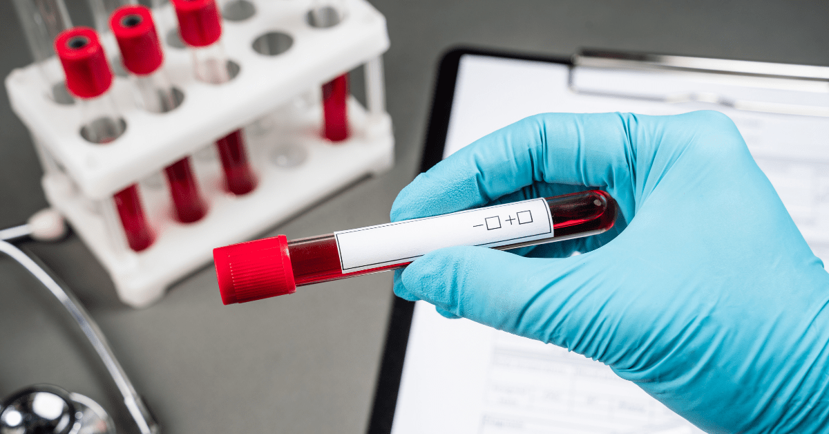 Portable quantitative screening test for prostate-specific antigen at ...