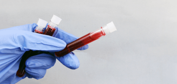 Blood cell quantification on dry blood samples: toward patient-centric ...