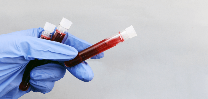 Blood cell quantification on dry blood samples: toward patient-centric ...
