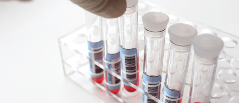 Case study: preclinical PK drug screen using the Gyrolab immunoassay ...