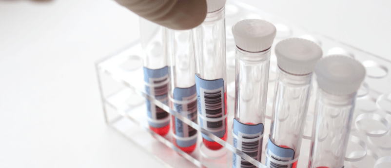 Case study: preclinical PK drug screen using the Gyrolab immunoassay platform - Bioanalysis Zone