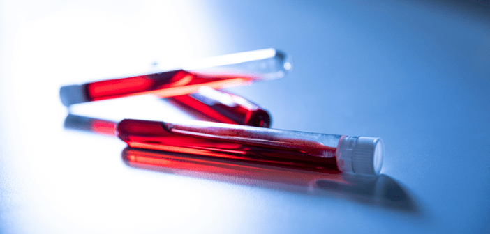 A whole blood microsampling furosemide assay: development, validation ...