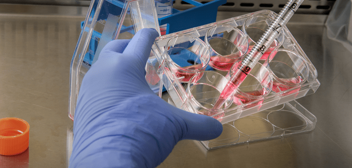 Considerations for biodistribution and viral shedding assays in regulated bioanalysis ...