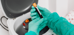 Volumetric absorptive microsampling–LC–MS/MS assays for quantitation of giredestrant in dried ...